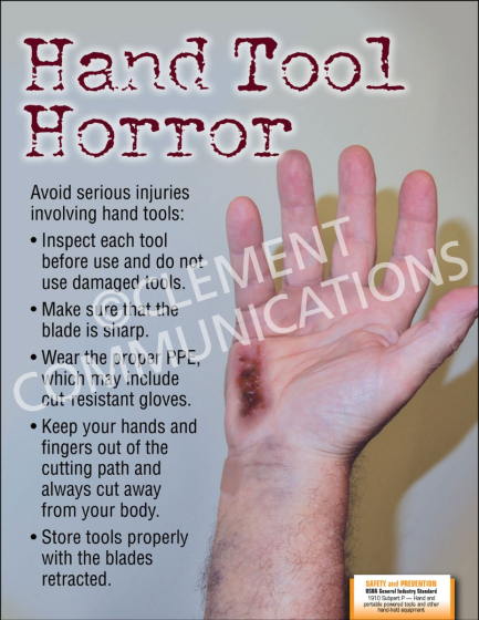 Hand Injury Poster